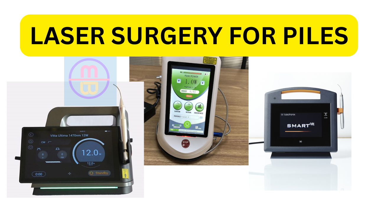 Laser Surgery for Piles: A Pain-Free Solution for Quick Relief ...