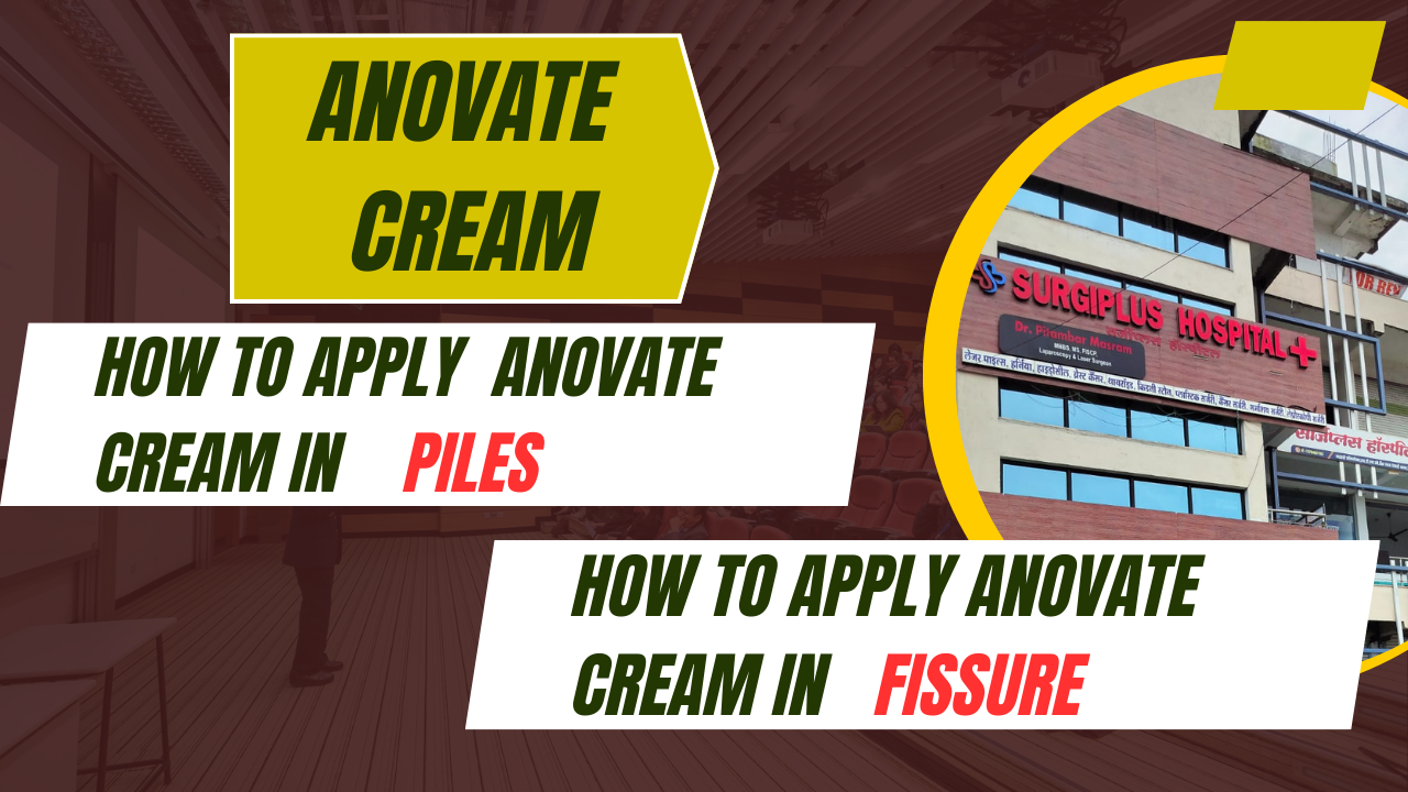 How to Apply Anovate Cream for Piles, A Complete Guide - Surgiplus Hospital